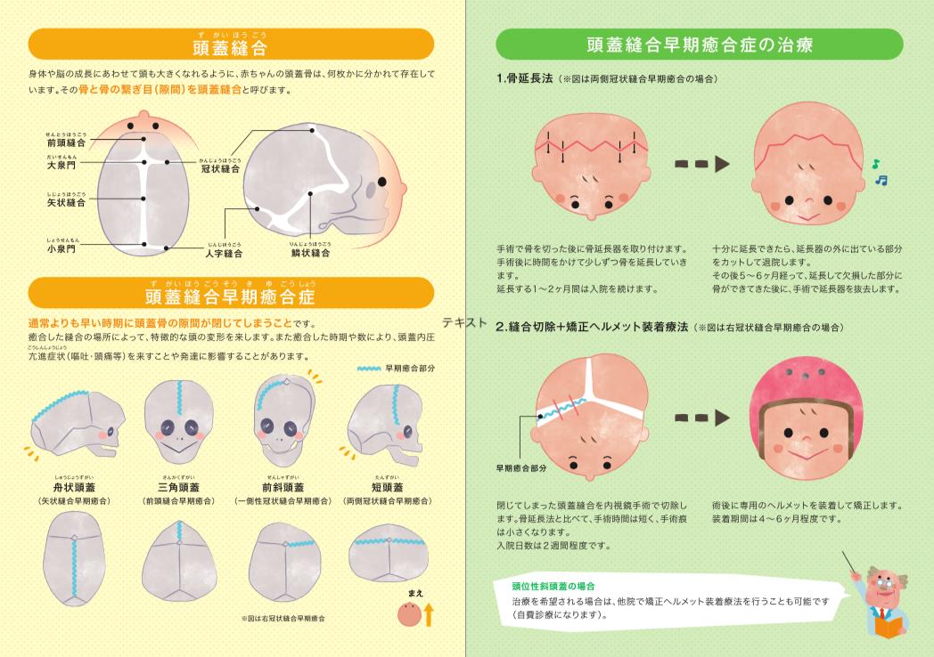 頭蓋骨の形状異常の原因とその治療法 健康百科事典